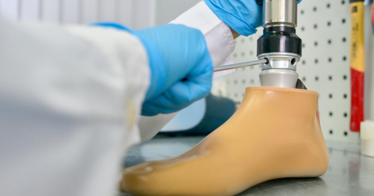 Do I Really Need an Amputation? | Ochsner Health