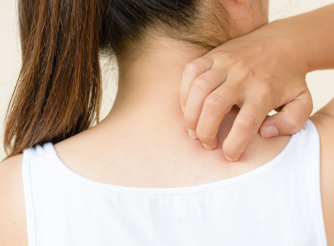 Ringworm On Back Of Neck