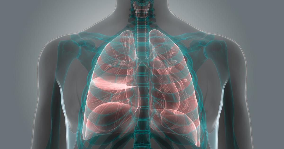 What is Pulmonary Fibrosis? | Ochsner Health