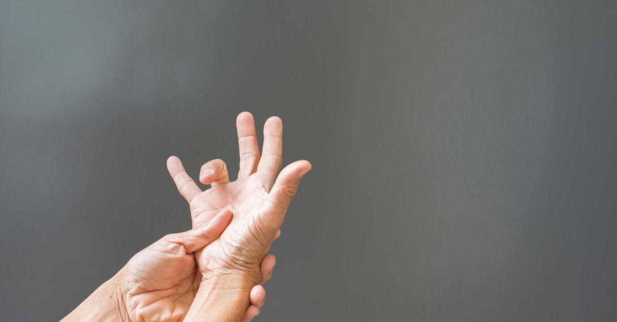 Why Is My Finger Bent? 5 Things To Know About Dupuytren’s Contracture ...